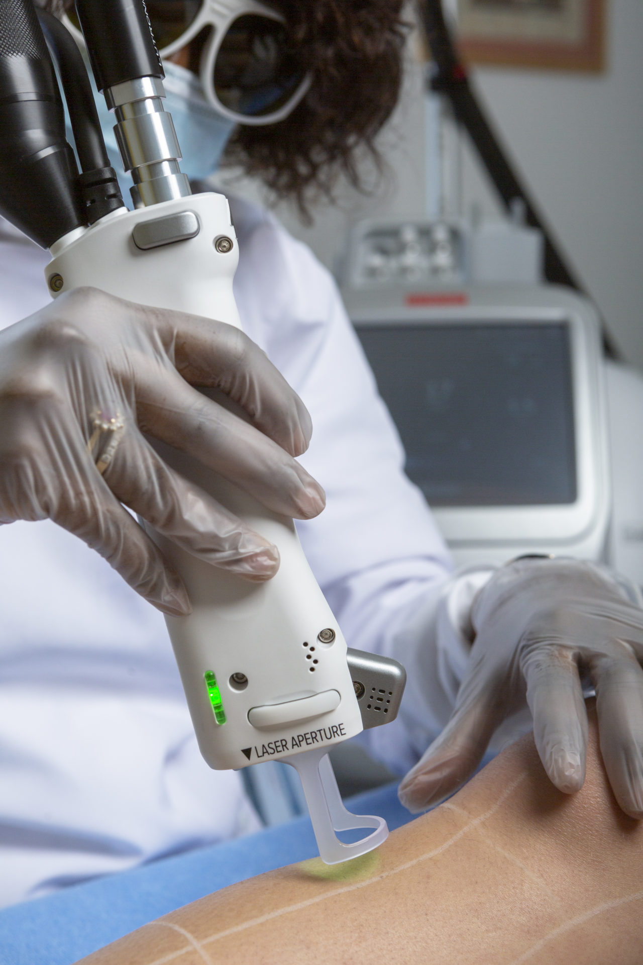 Épilation définitive laser - Clinique Laser du Parc Wattignies